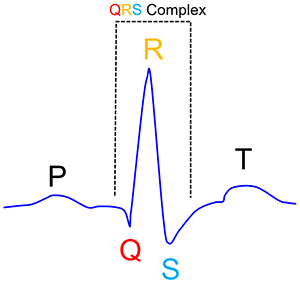 ECG Design Using a Differential Amplifier and ADC | DigiKey
